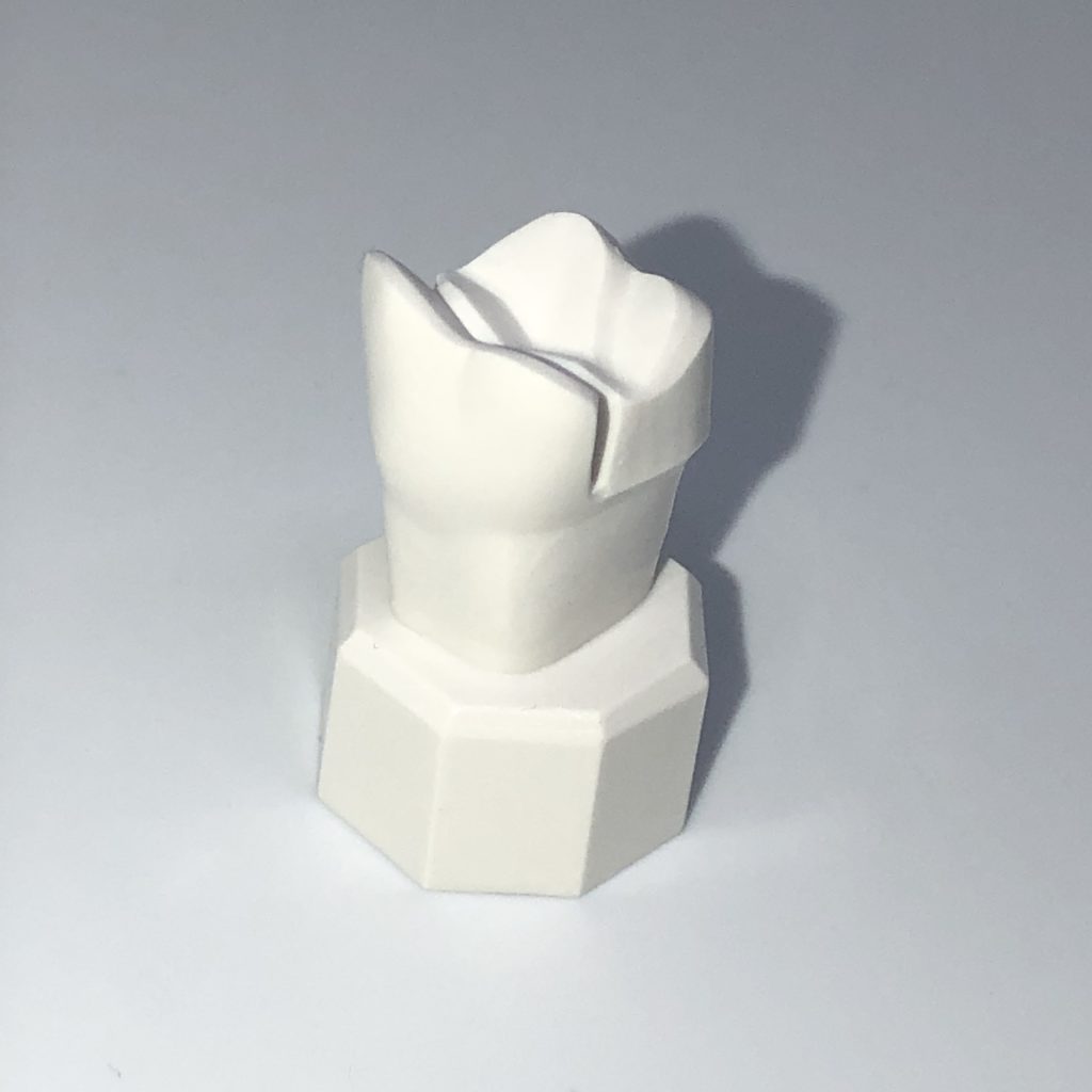 Sample prep of MOD onlay on upper first molar – The Doctor Tools